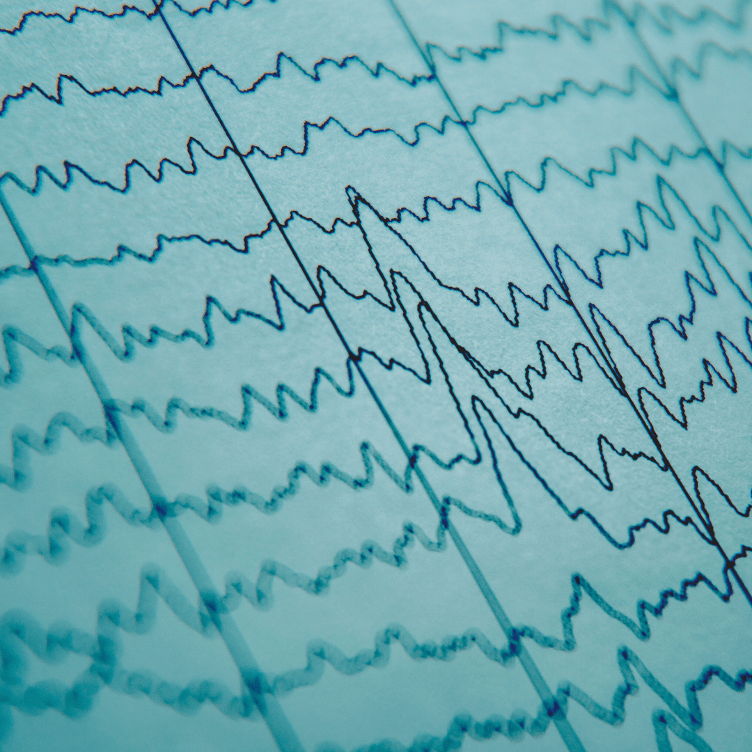 Qu'est-ce qu'un EEG ? | OTIMROEPMQ