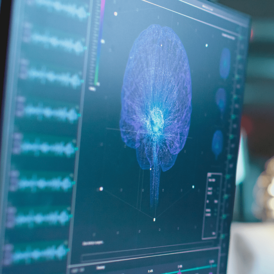 Qu'est-ce qu'un EEG ? | OTIMROEPMQ