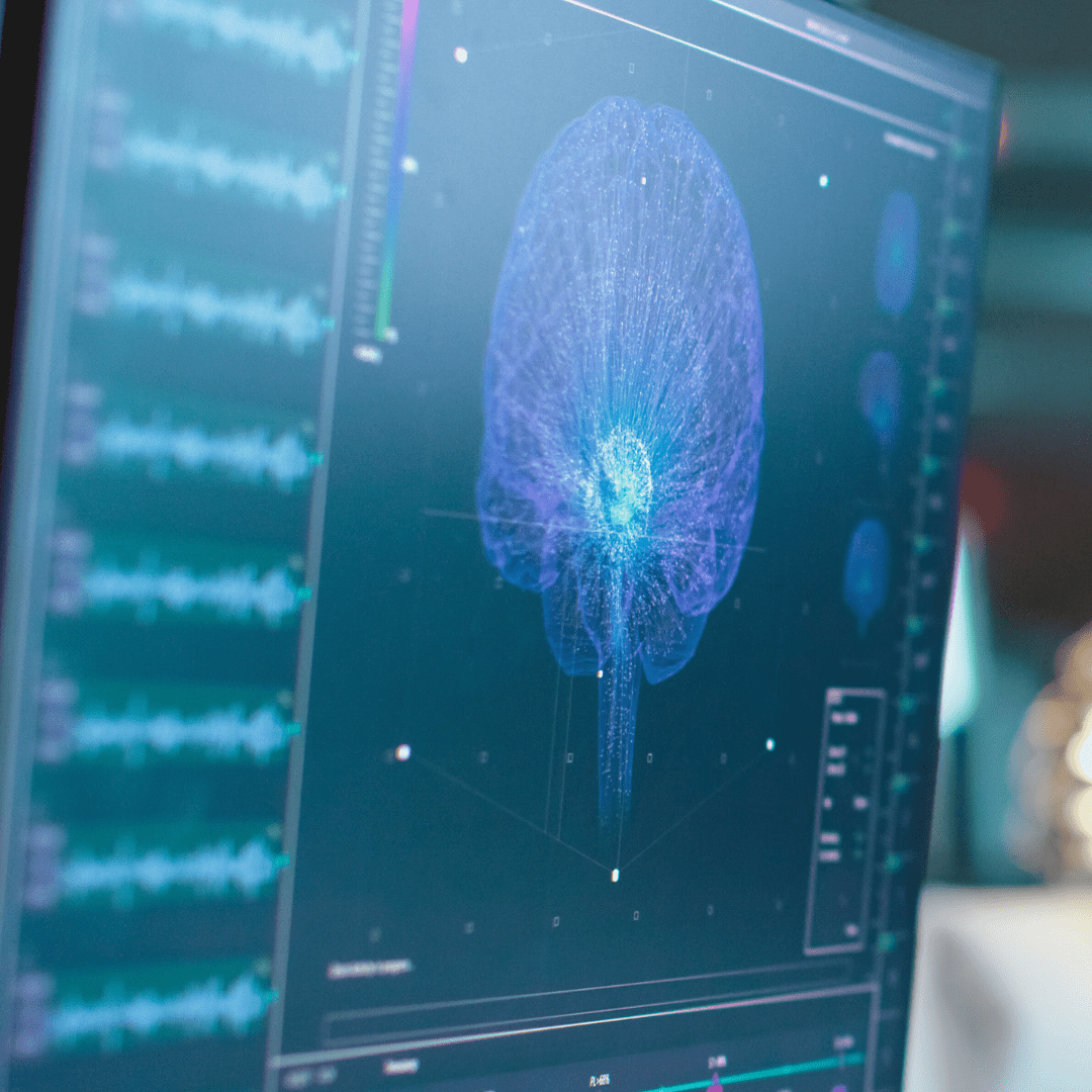 Qu'est-ce qu'un EEG ? | OTIMROEPMQ